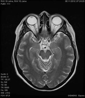 Robert-Koch-Krankenhaus Apolda: Magnetresonanz- tomografie (MRT)